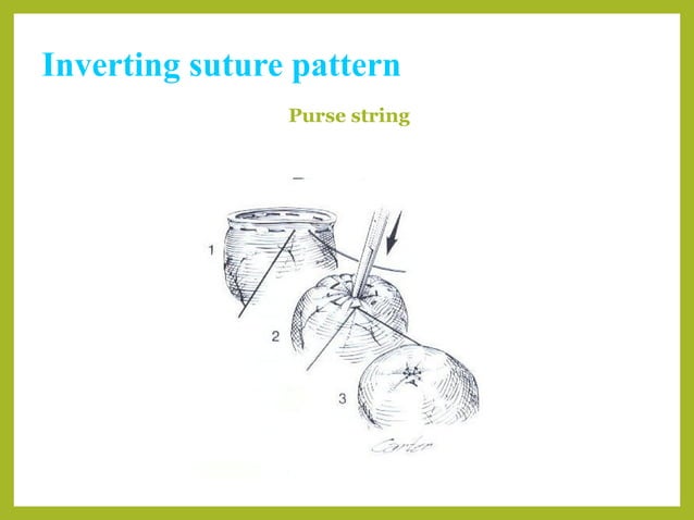 Basic suture patterns | PPT