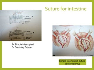 Basic suture patterns | PPT