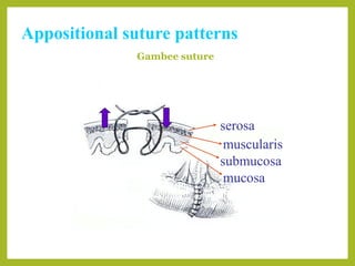 Basic suture patterns | PPT