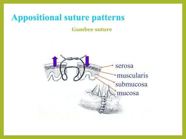 Basic suture patterns | PPT