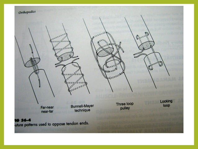 Basic suture patterns | PPT