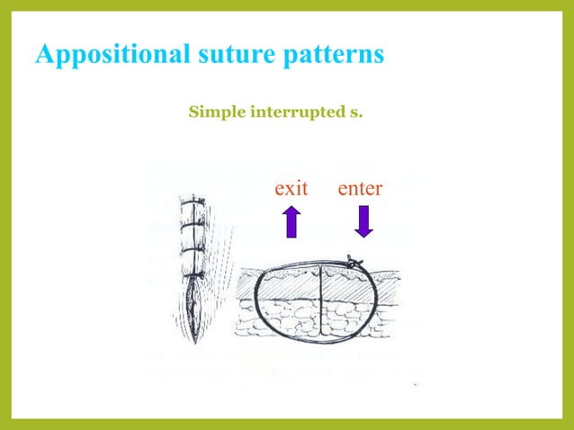 Basic suture patterns | PPT