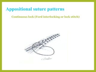 Basic suture patterns | PPT
