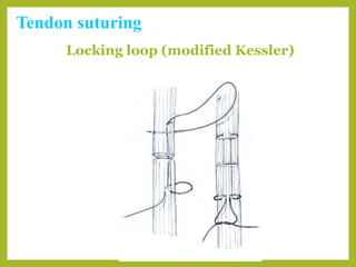Basic suture patterns | PPT