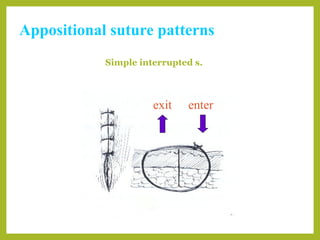 Basic suture patterns | PPT