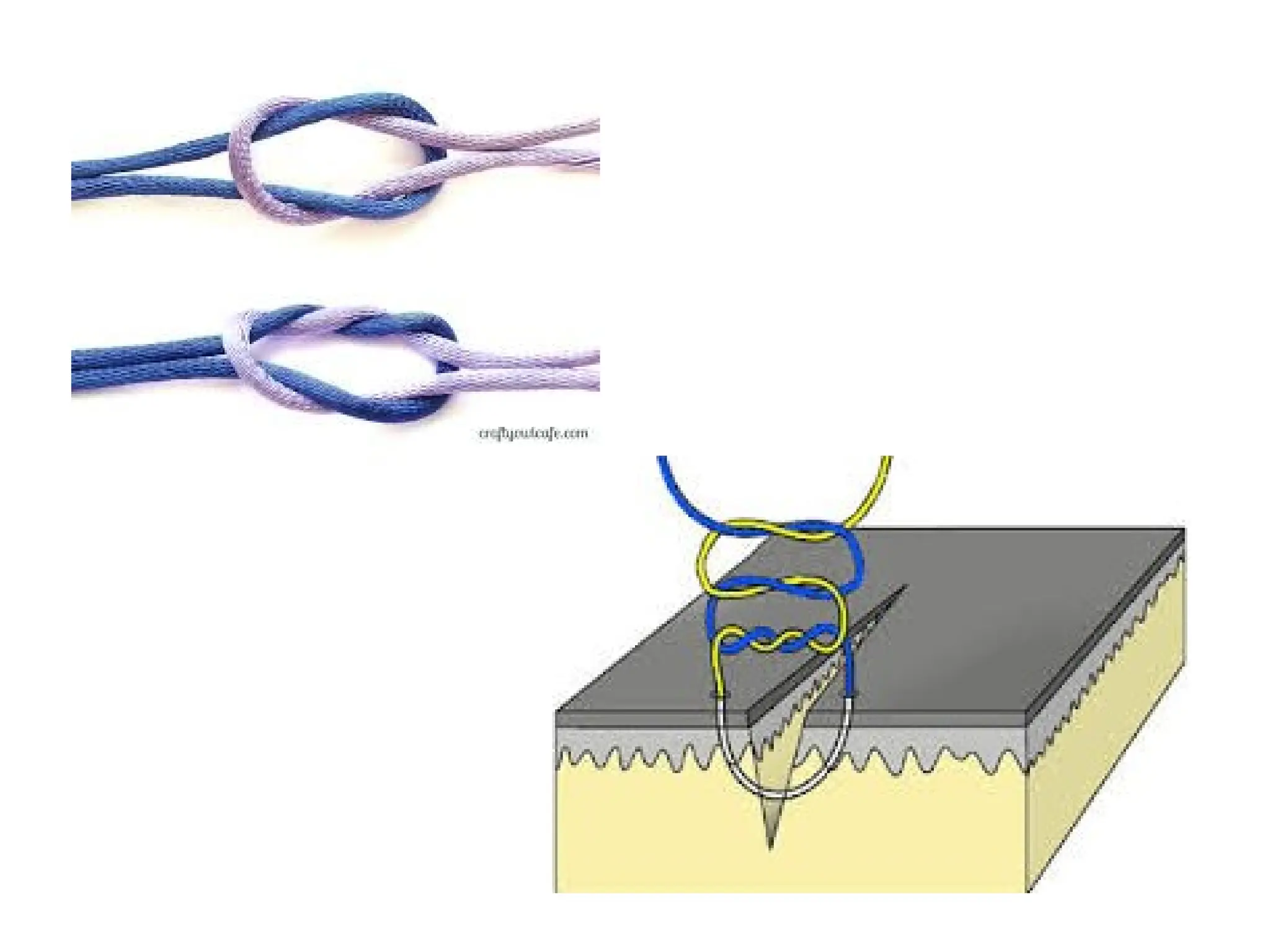 Basic Suturing dari bedah bisa dilihat dan .pptx
