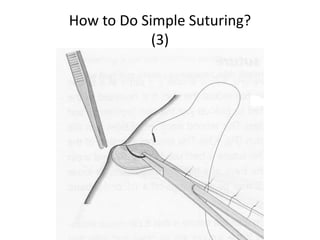 Basic Suturing Manual.ppt