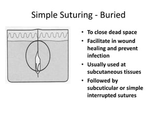 Basic Suturing Manual.ppt