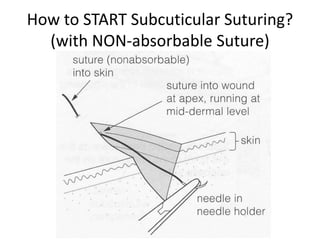 Basic Suturing Manual.ppt