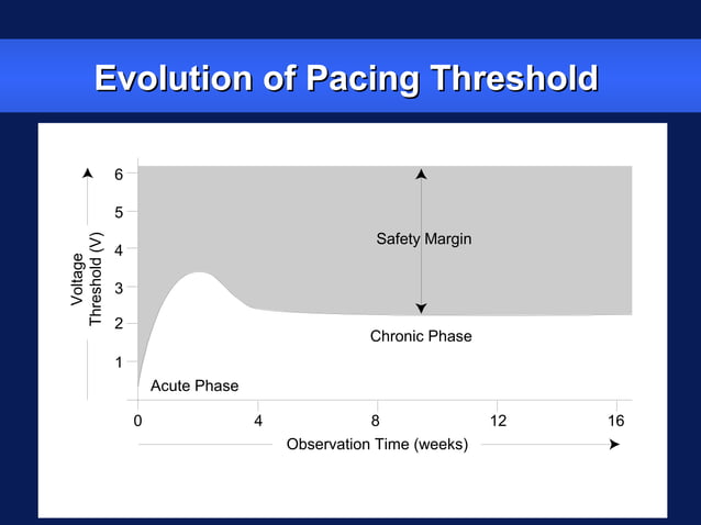 Basic technical concepts in cardiac pacing | PPT