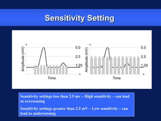 Basic technical concepts in cardiac pacing | PPT