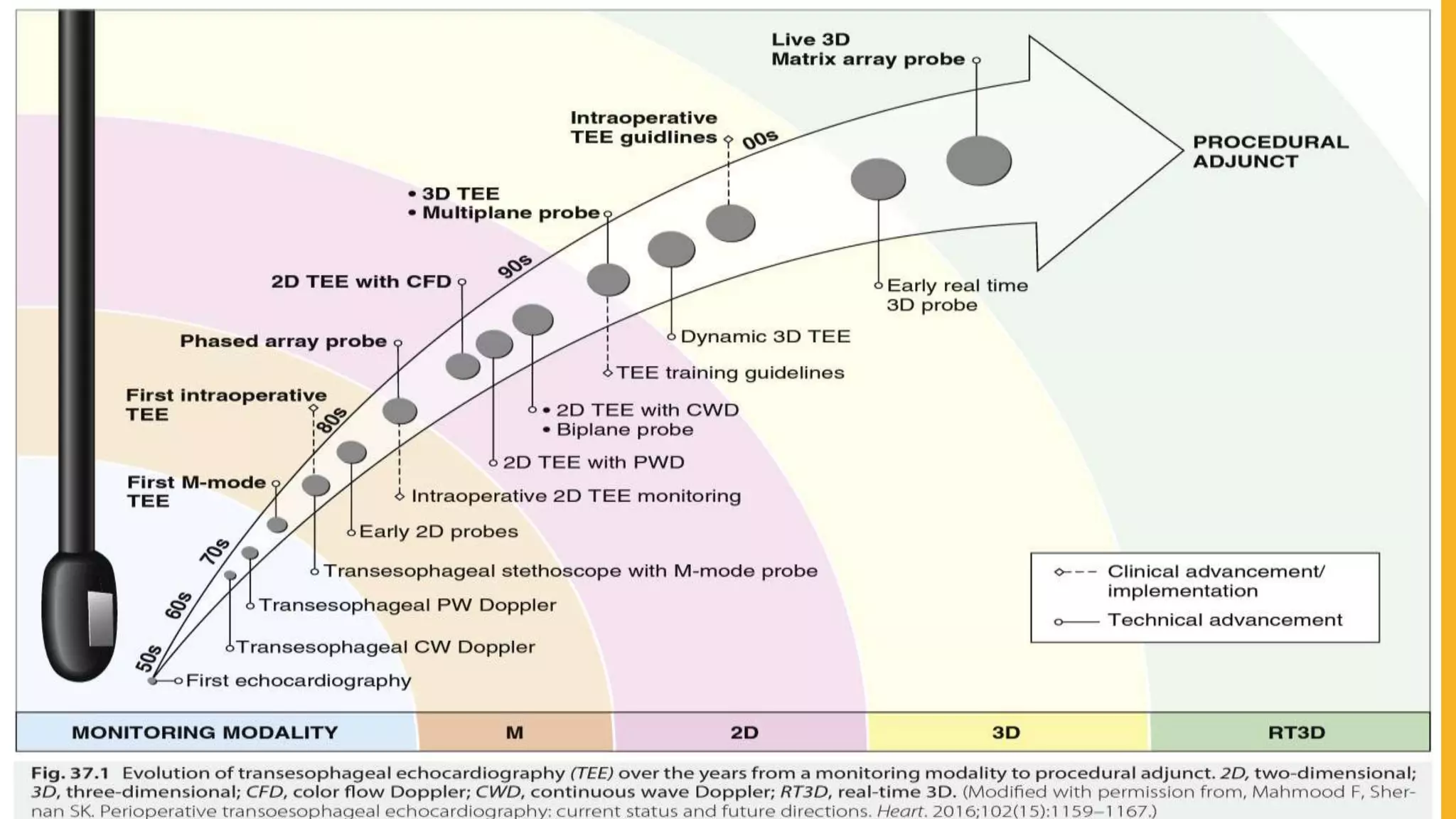 Basic transesophageal echo TEE anaesthesia | PPTX