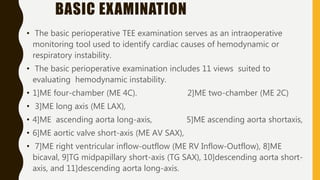 Basic transesophageal echo TEE anaesthesia | PPTX