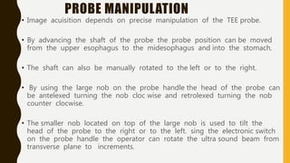 Basic transesophageal echo TEE anaesthesia | PPTX