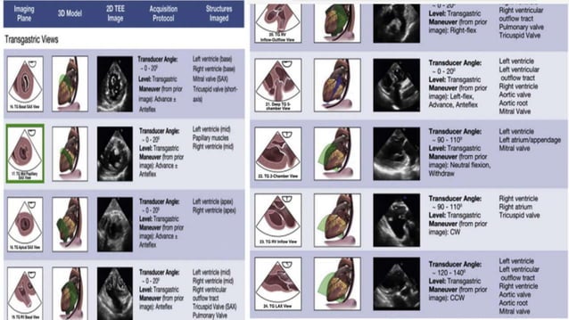 Basic transesophageal echo TEE anaesthesia | PPT