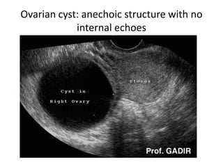 BASIC ULTRASOUND.pdf