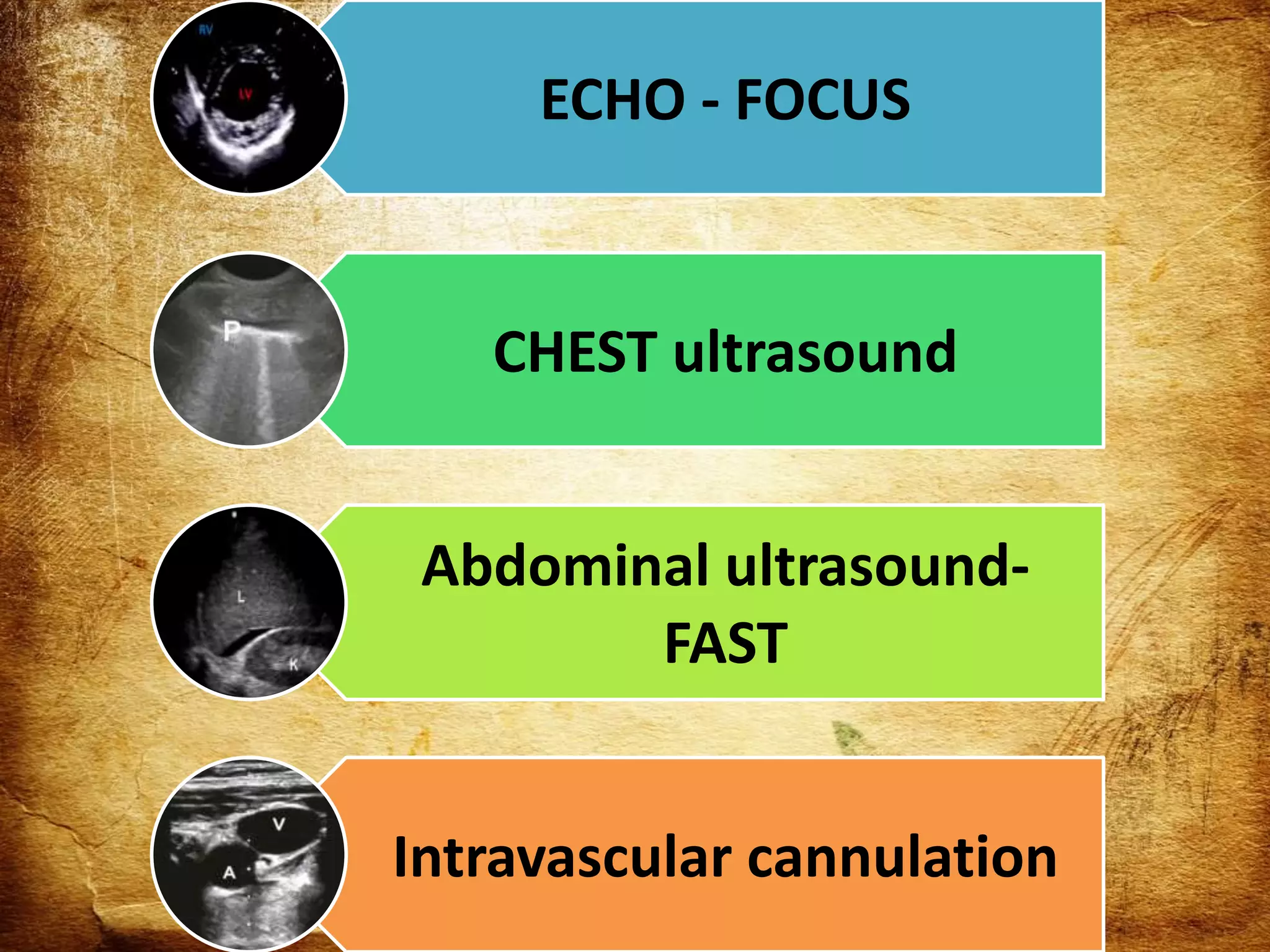 Basic ultrasound in icu | PPTX