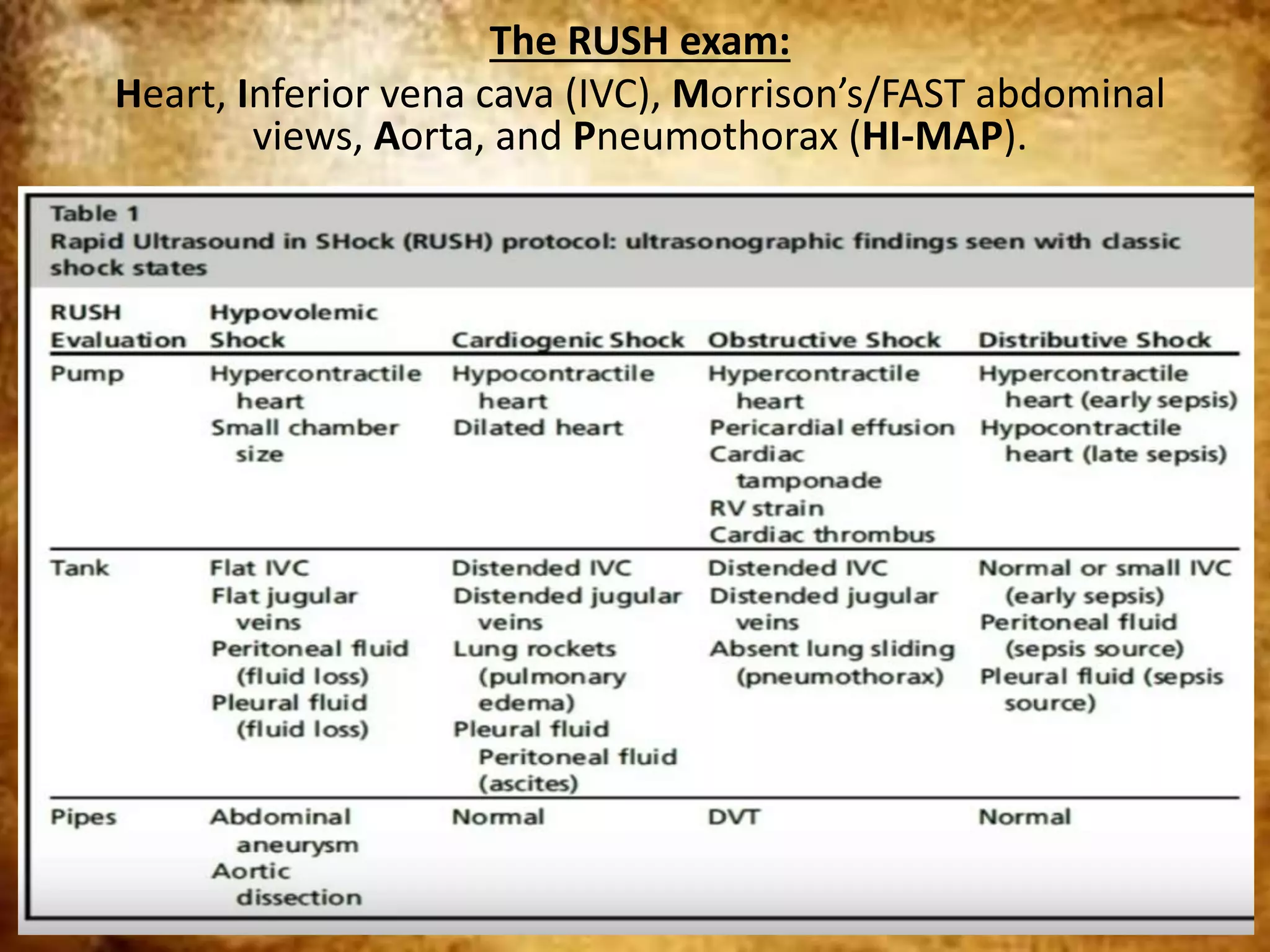 Basic ultrasound in icu | PPTX