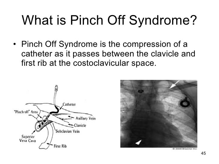 Basic Vascular Access Ice Ppt Presentation.Ppt2