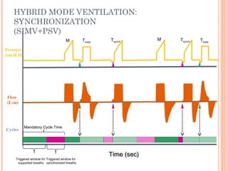 Basic ventilatory modes | PPT