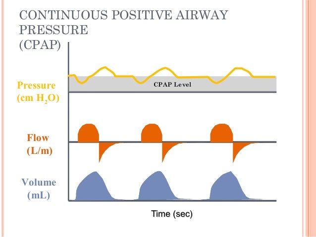 Basic ventilatory modes
