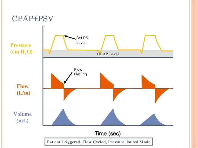 Basic ventilatory modes