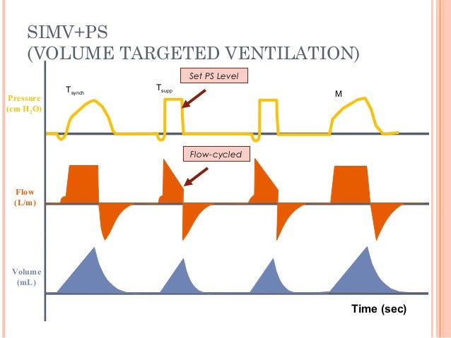 Basic ventilatory modes