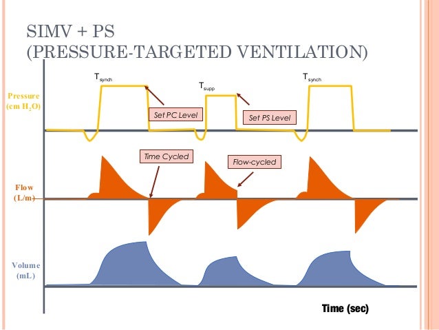 Basic ventilatory modes