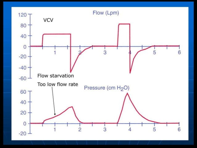 Basic ventilatory parameters | PPTX | Lung and Respiratory Health ...