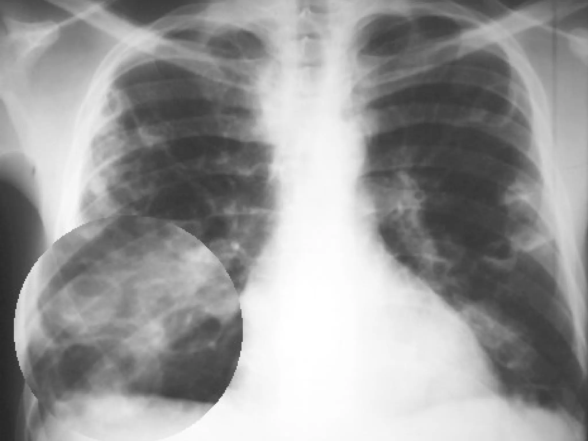 Basic X-Rays For Students; A radiology guide.pptx