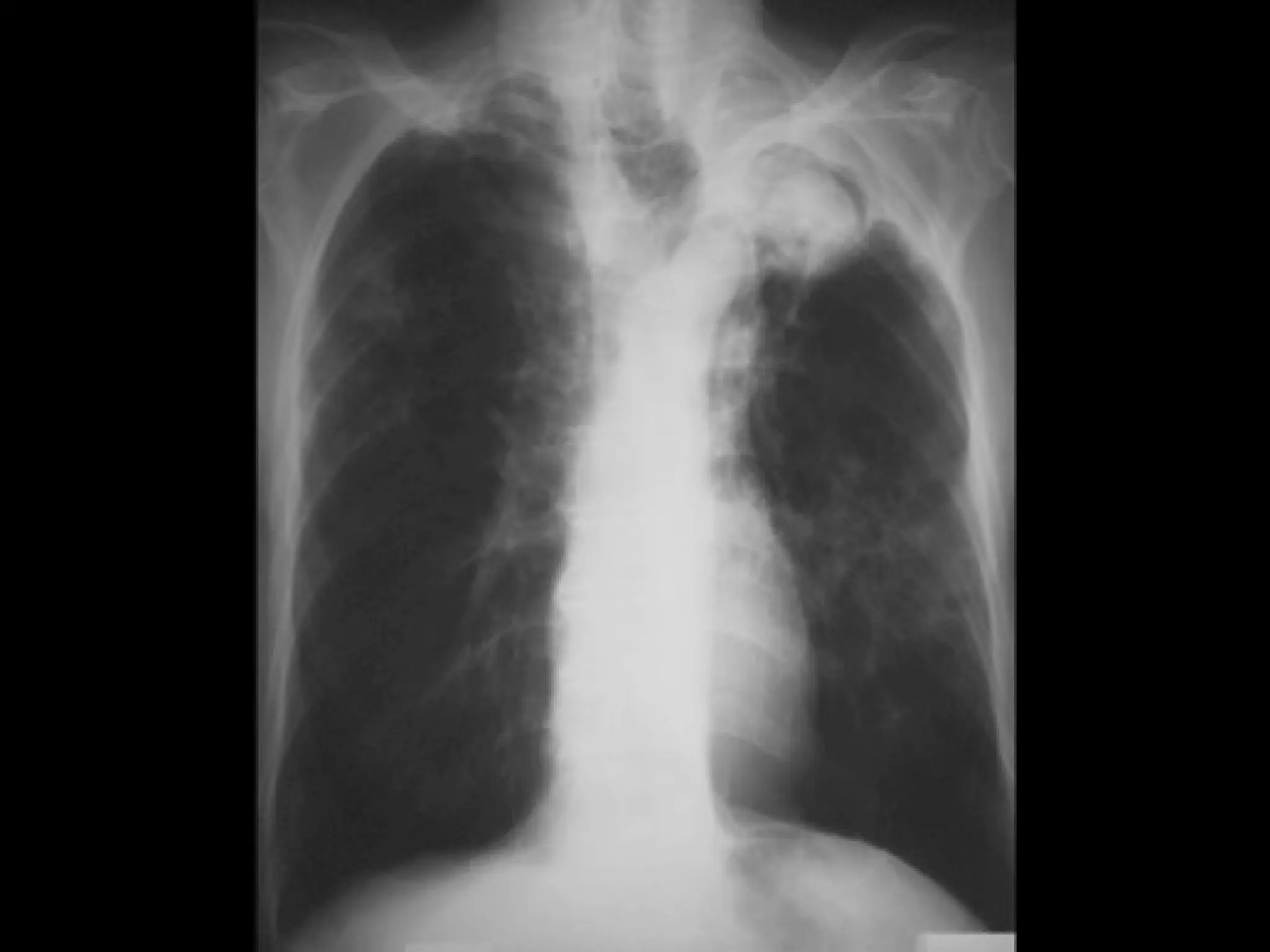 Basic X-Rays For Students; A radiology guide.pptx