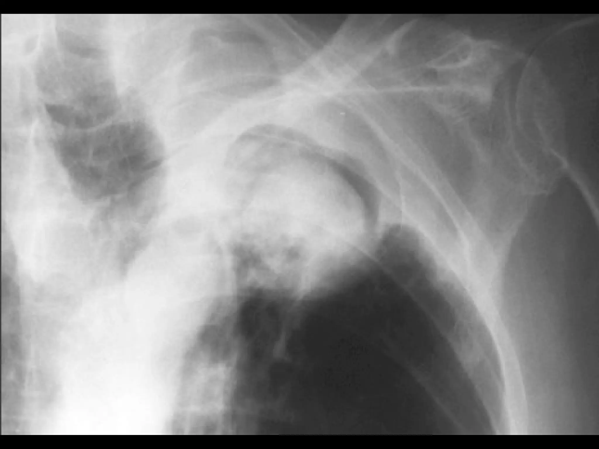 Basic X-Rays For Students; A radiology guide.pptx