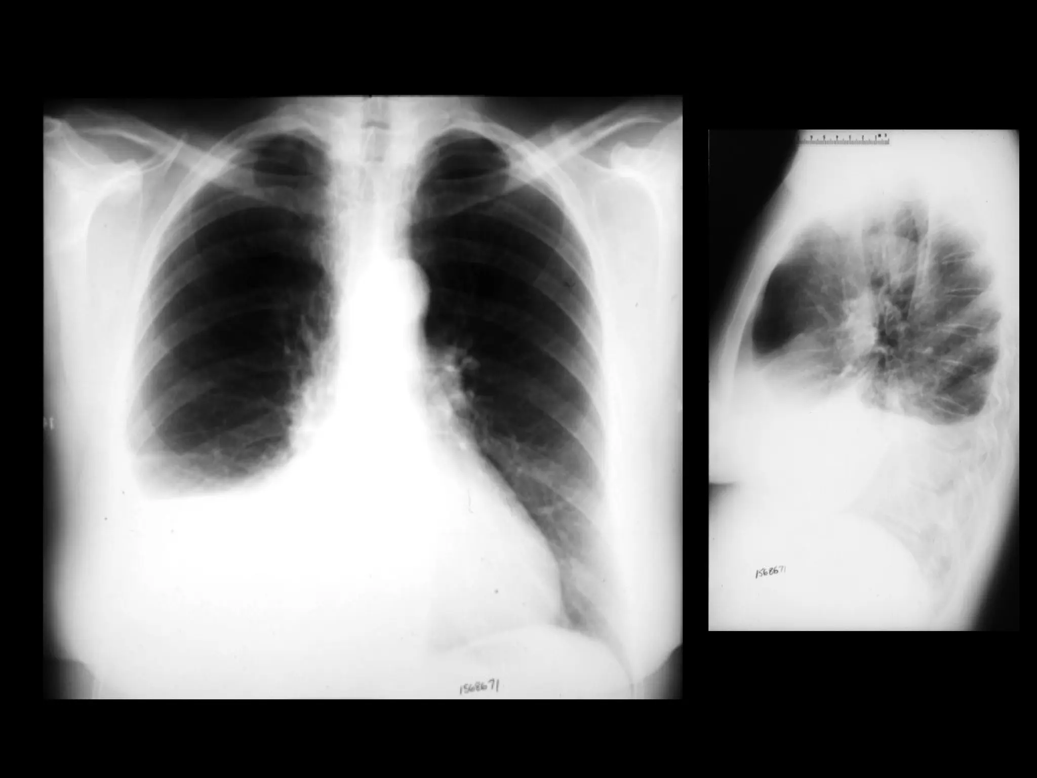 Basic X-Rays For Students; A radiology guide.pptx