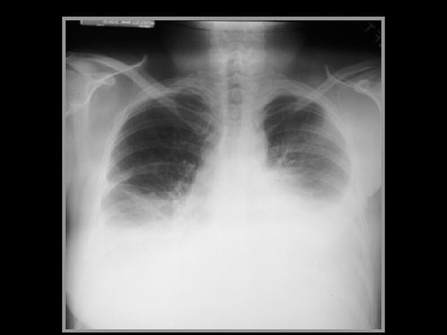 Basic X-Rays For Students; A radiology guide.pptx