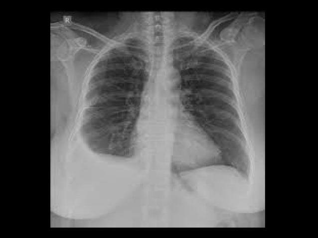Basic X-Rays For Students; A radiology guide.pptx