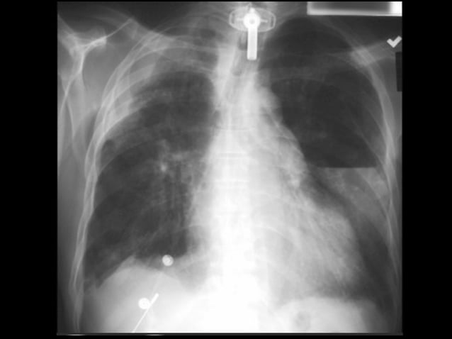 Basic X-Rays For Students; A radiology guide.pptx