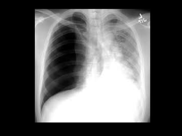 Basic X-Rays For Students; A radiology guide.pptx