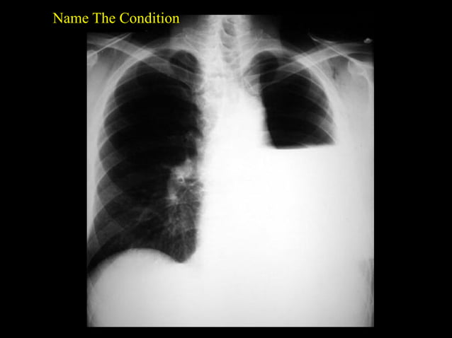 Basic X-Rays For Students; A radiology guide.pptx