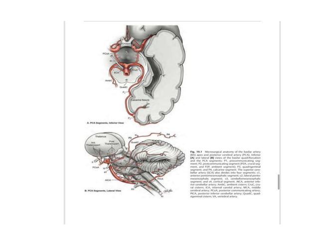 basilar artery.pptx | Brain and Nervous System Disorders | Diseases and ...