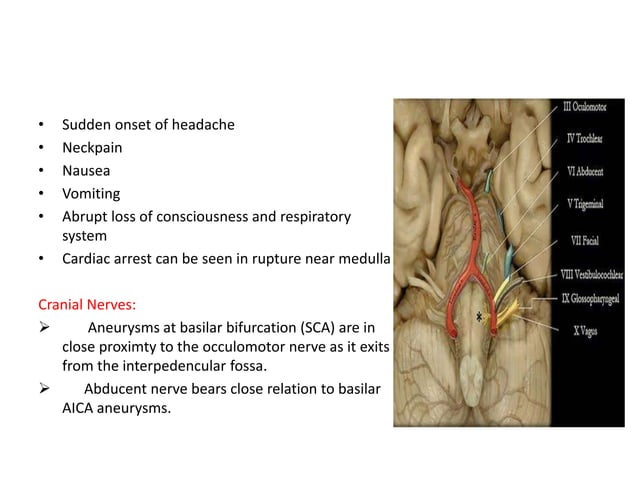 basilar artery.pptx | Brain and Nervous System Disorders | Diseases and ...