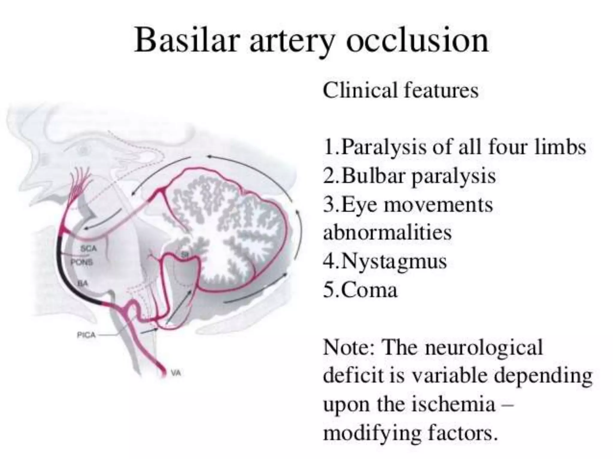 Basilar artery occlusion | PPTX
