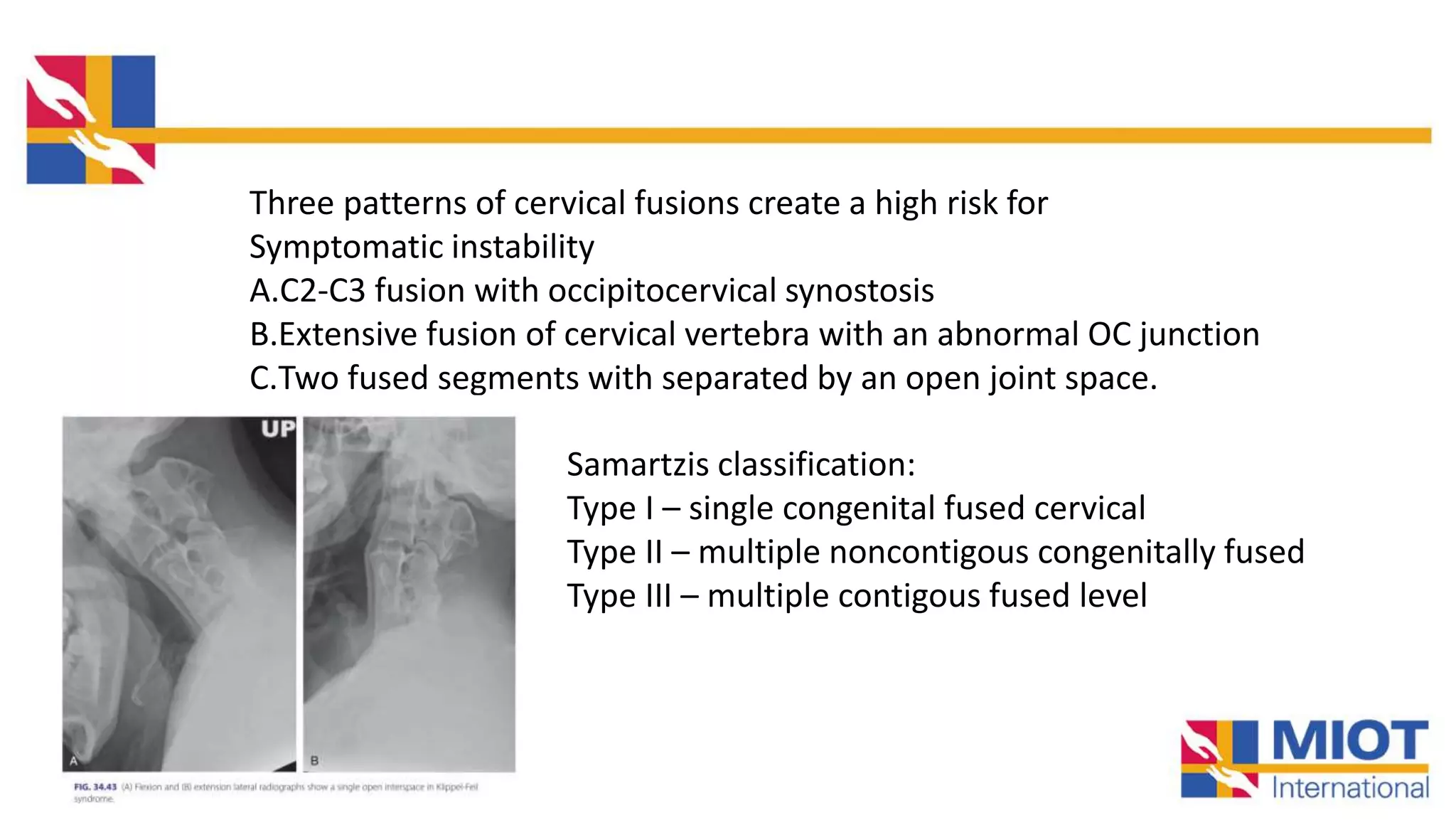 Basilar invagination | PPTX