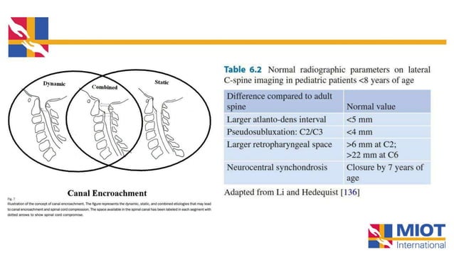 Basilar invagination | PPTX