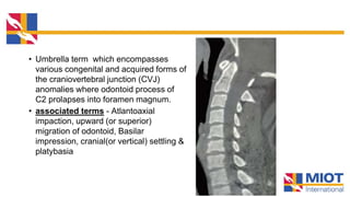 Basilar invagination | PPTX