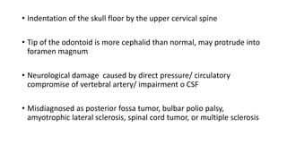 Basilar invagination | PPTX