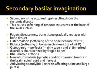 BASILAR INVAGINATION.pptx................ | PPTX