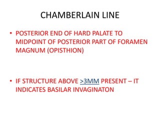 Basilar invagination lines | PPTX