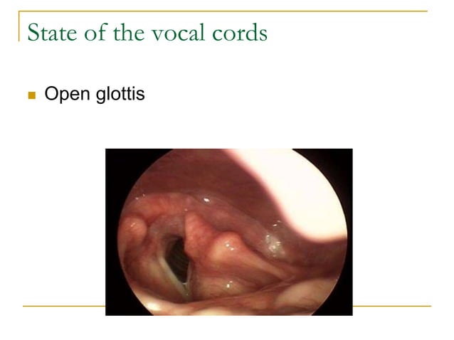 Basil Thomas- Articulatory Phonetics ppt | PPT