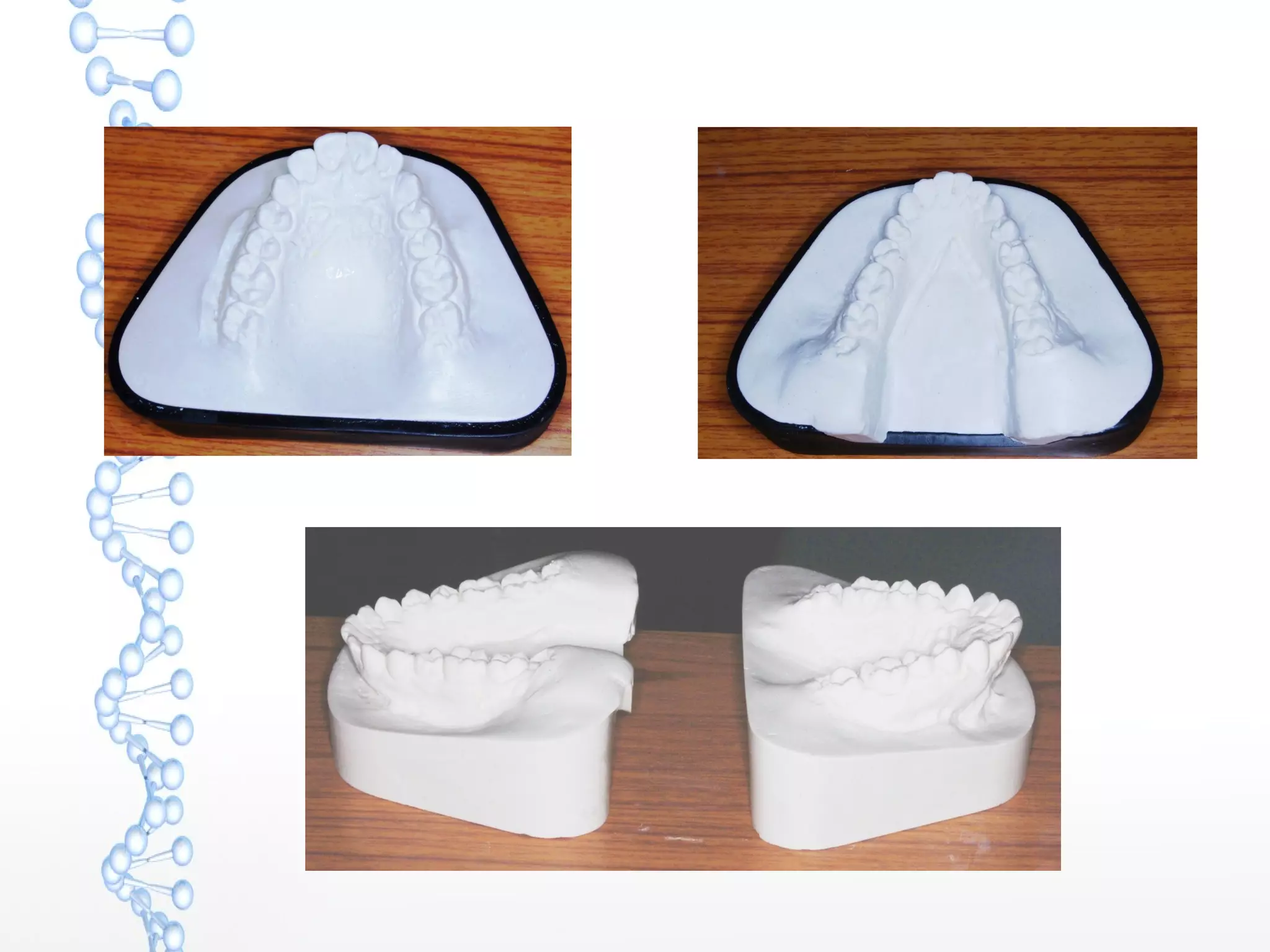BASING AND TRIMMING OF ORTHODONTIC MODELS | ODP