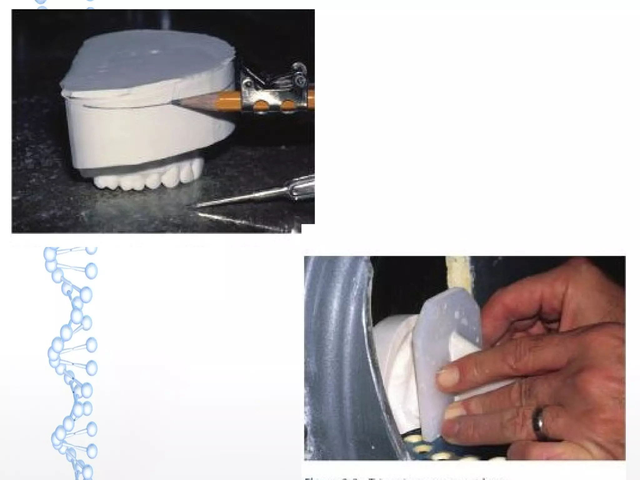 BASING AND TRIMMING OF ORTHODONTIC MODELS | ODP